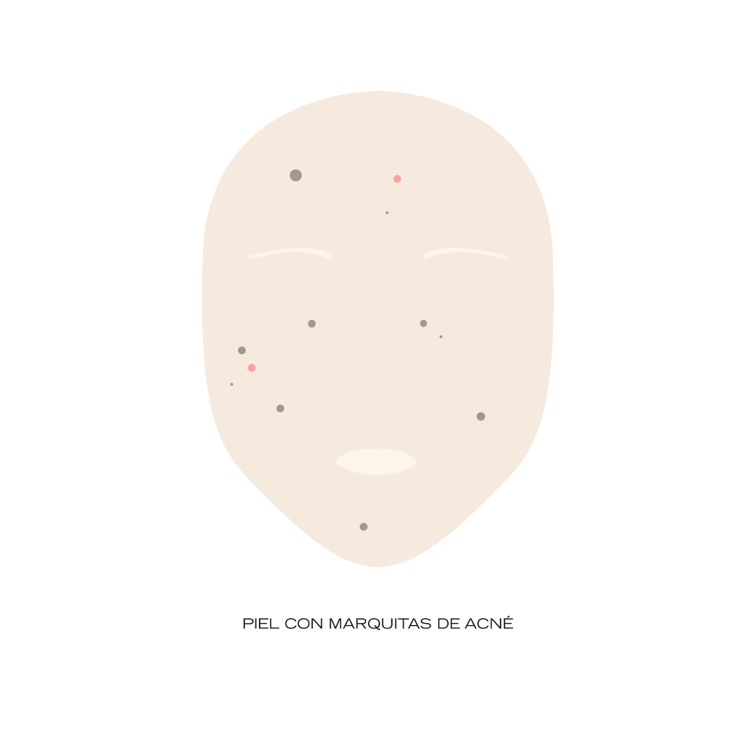 Marcas acné – ELISABETH ÁLVAREZ COSMETICS