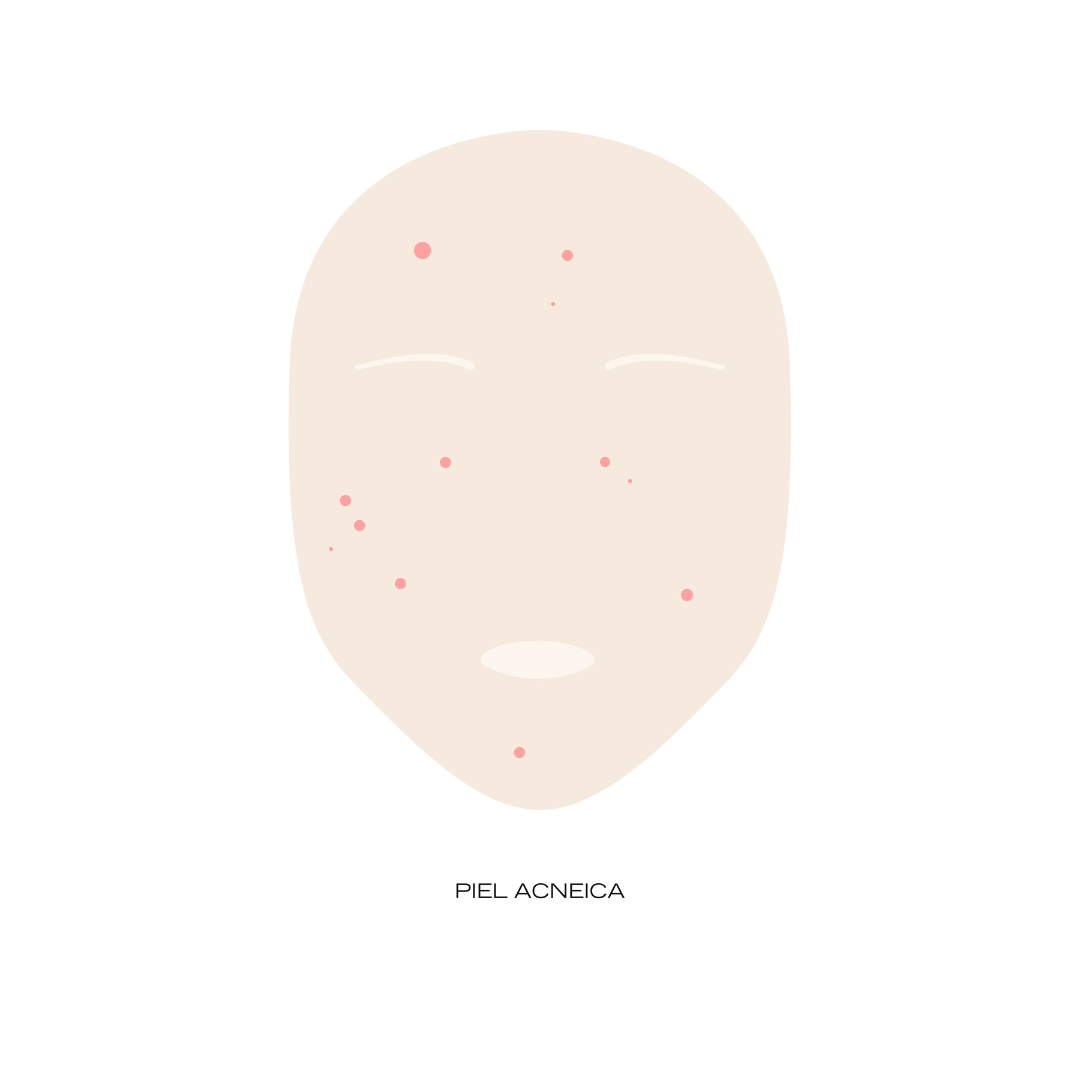 Acné – ELISABETH ÁLVAREZ COSMETICS